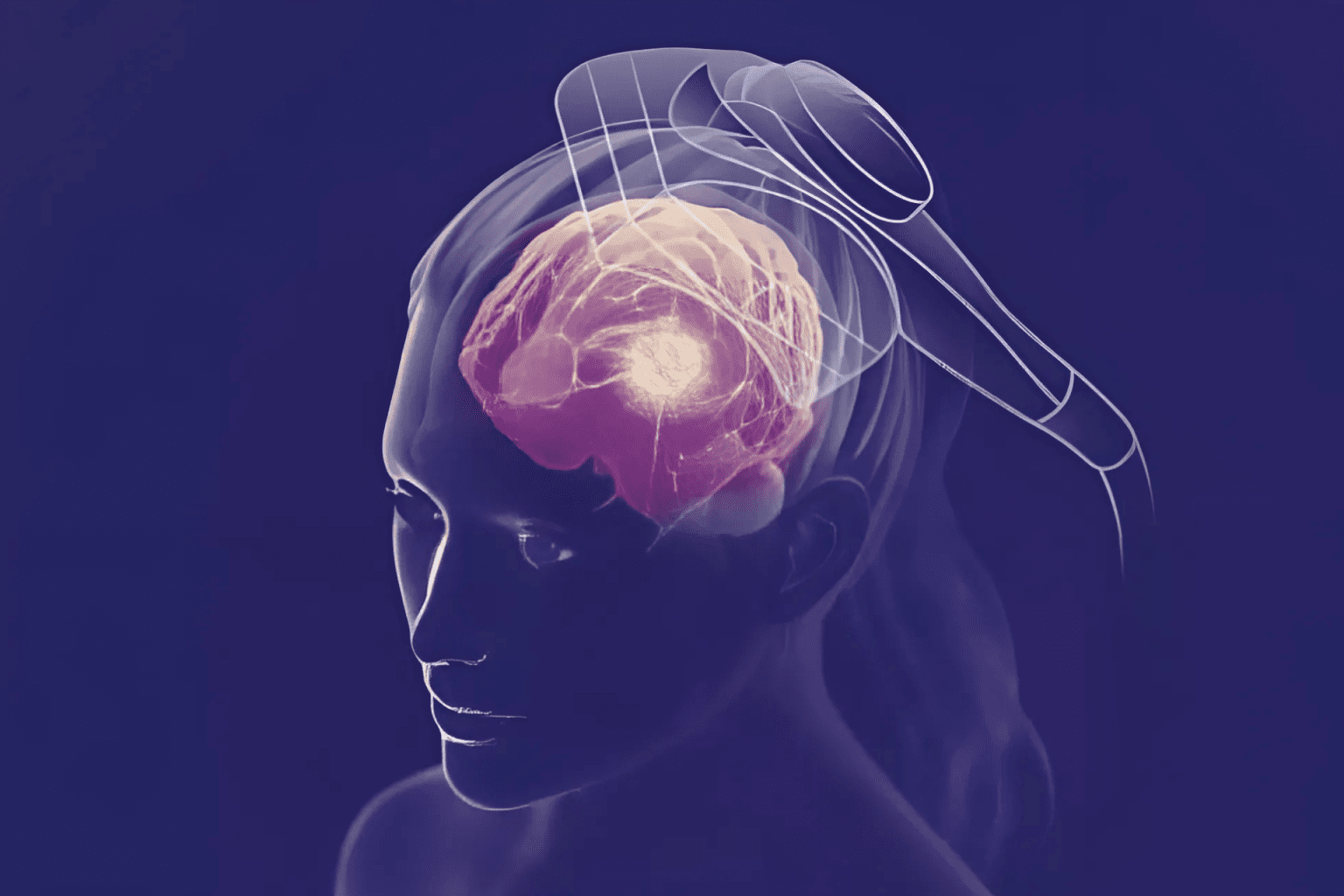 NeuroStar TMS Success Rate and Treatment Benefits - Lotus Psychiatry ...